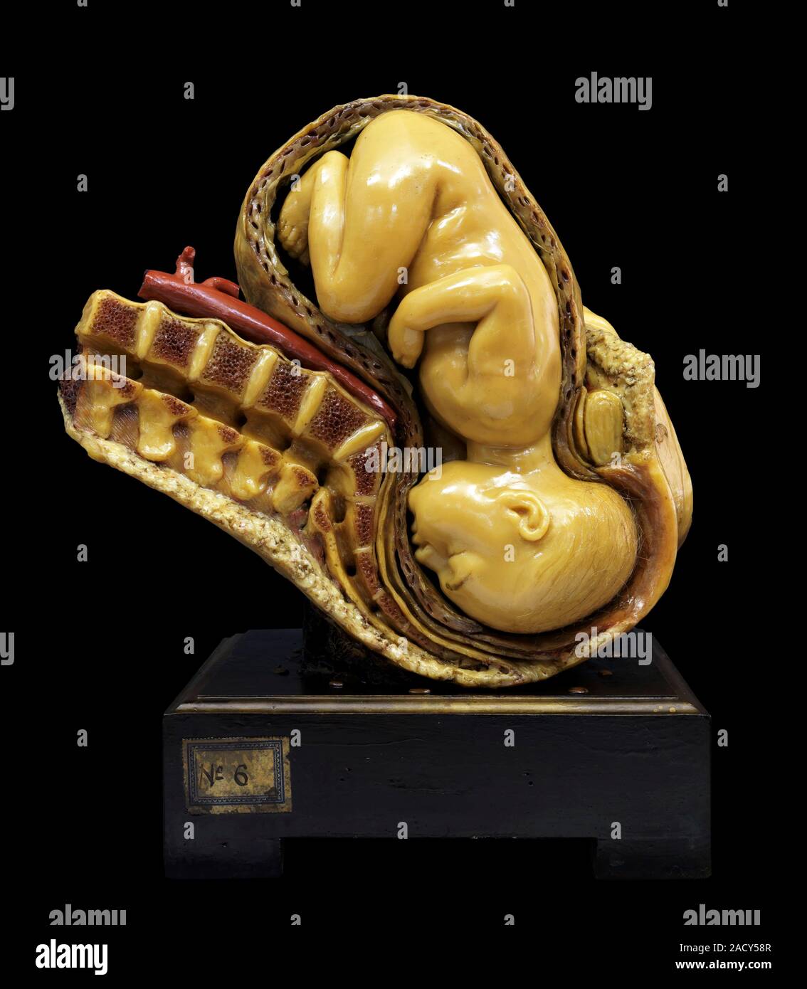 Pregnancy model. 18th-century wax and wood model of a foetus close to ...