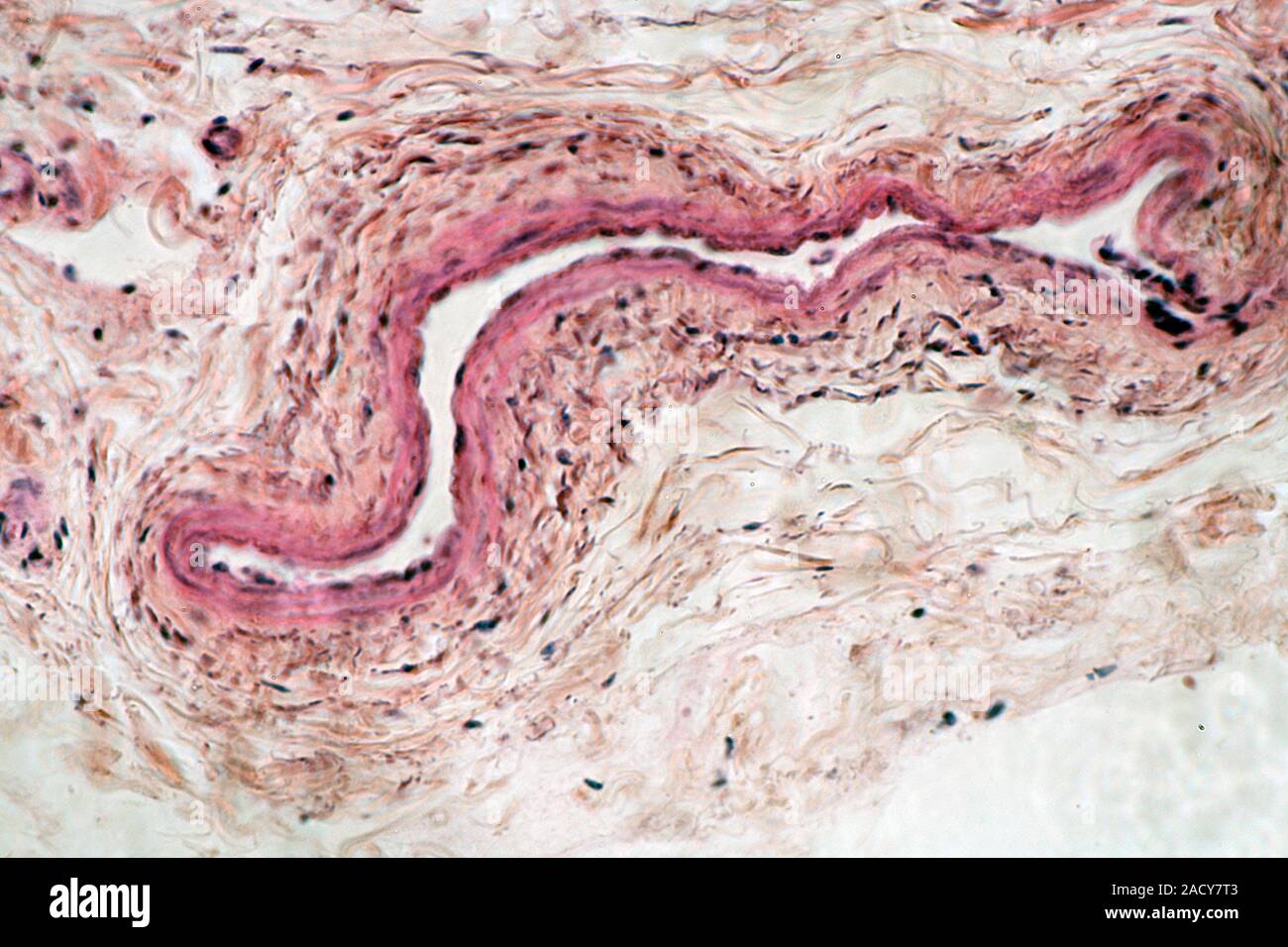 Vein cross-section. LM X100 Stock Photo - Alamy