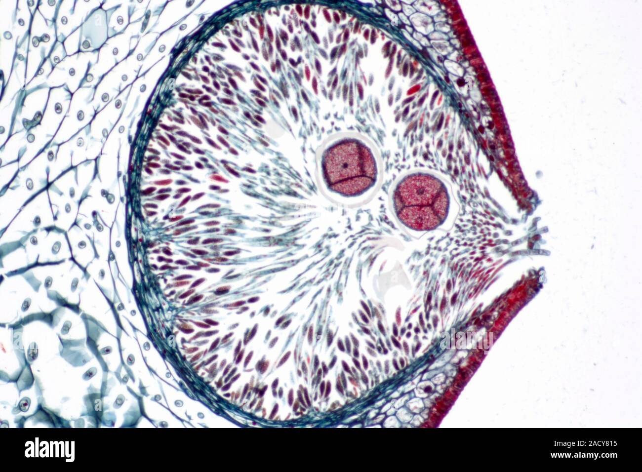 Brown Algae (Fucus) X.S. of the monoecious conceptacle. LM X25 Stock ...
