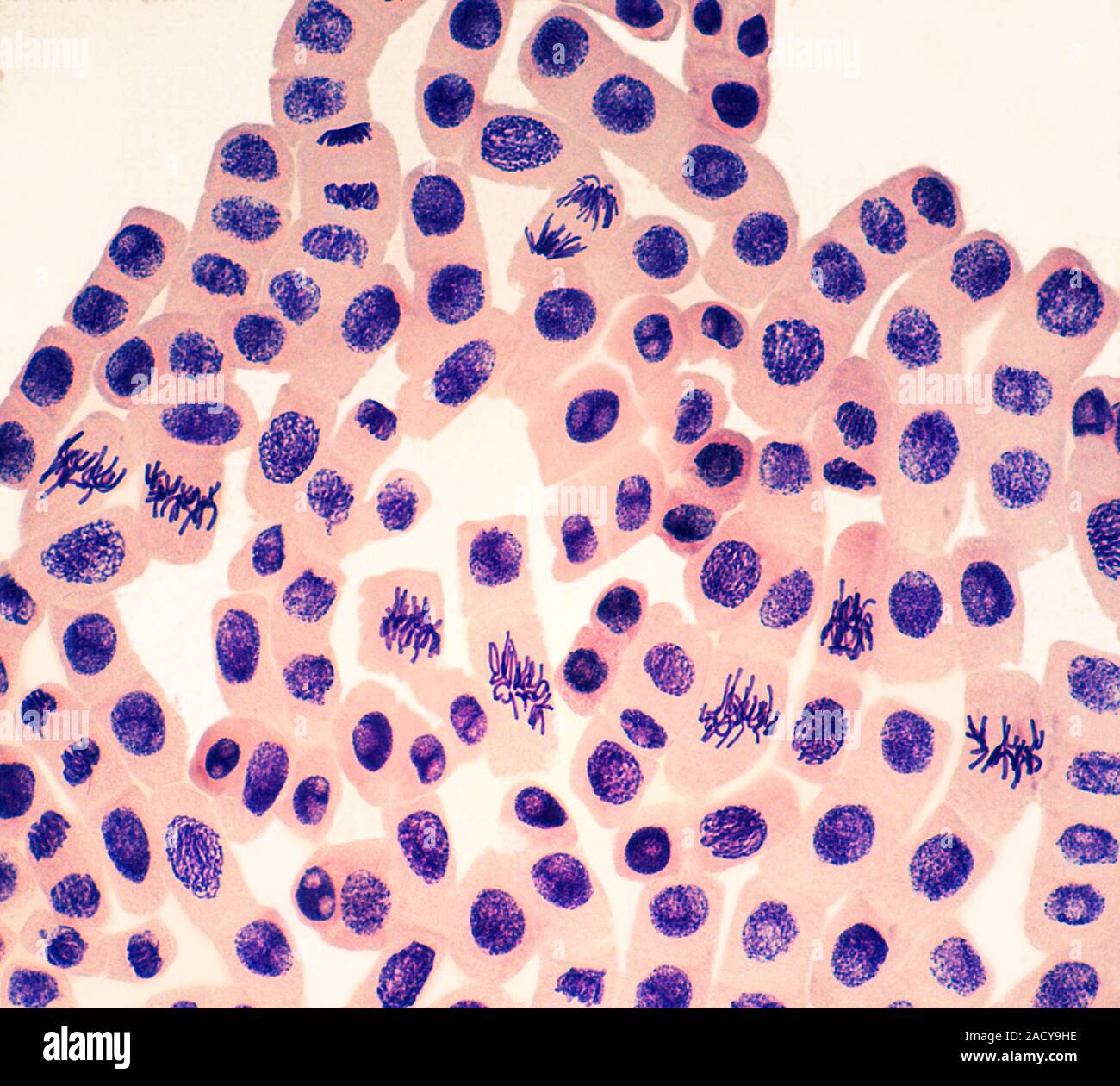 Plant cell mitosis. Light micrograph of root tip cells squash ...