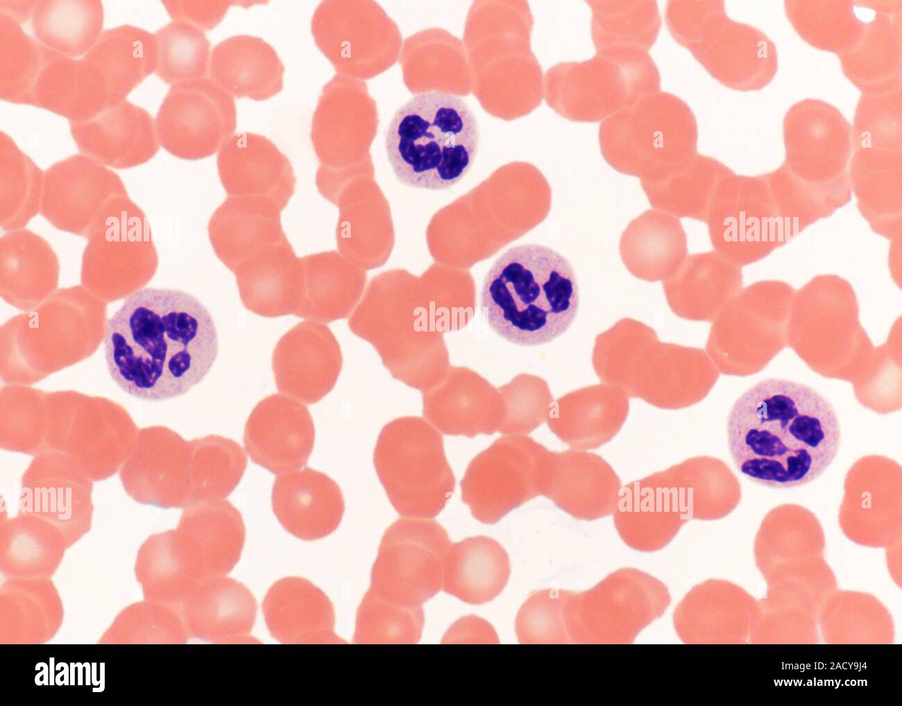 Light microscopy of a normal human blood smear showing four neutrophils ...