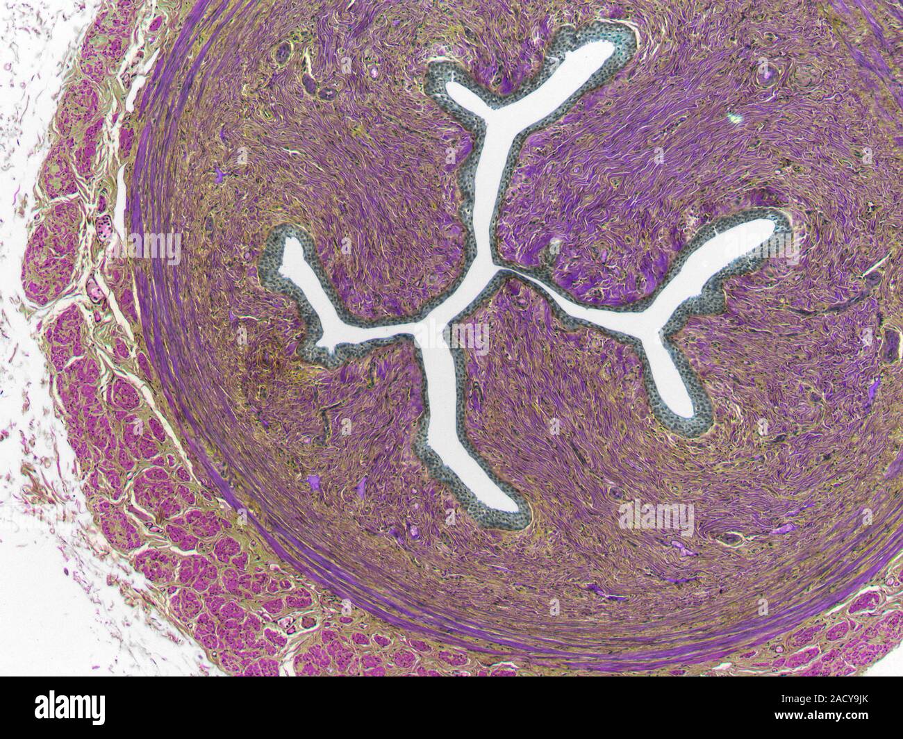 Light micrograph( LM) of a section through a ureter. The ureter is the ...