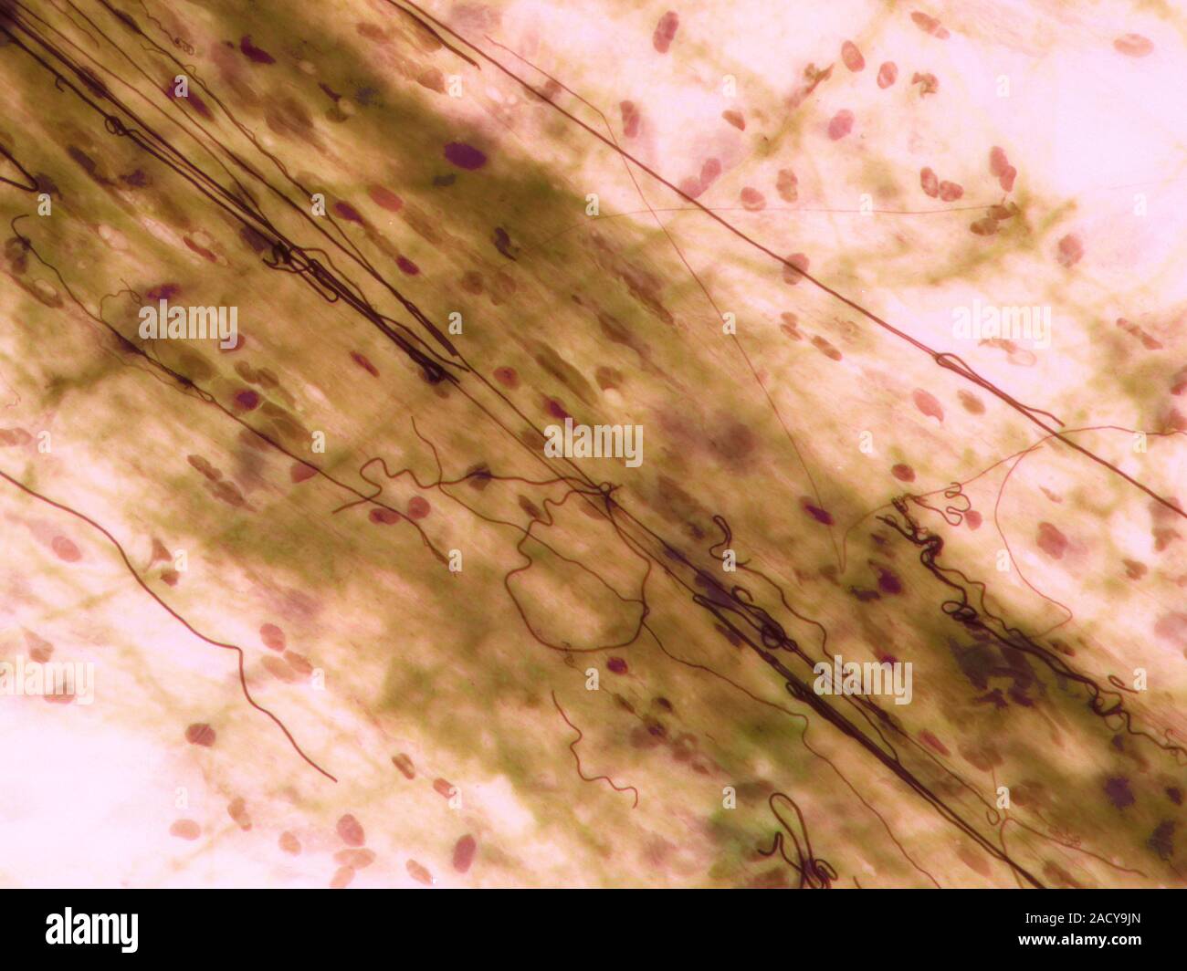 Light micrograph (LM) of loose connective tissue to show elastin fibers ...