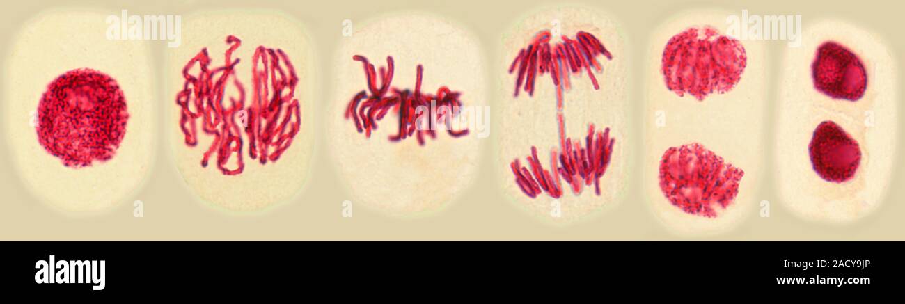 Mitosis Onion Root Tip Metaphase Mitosis Onion Root Tip Metaphase