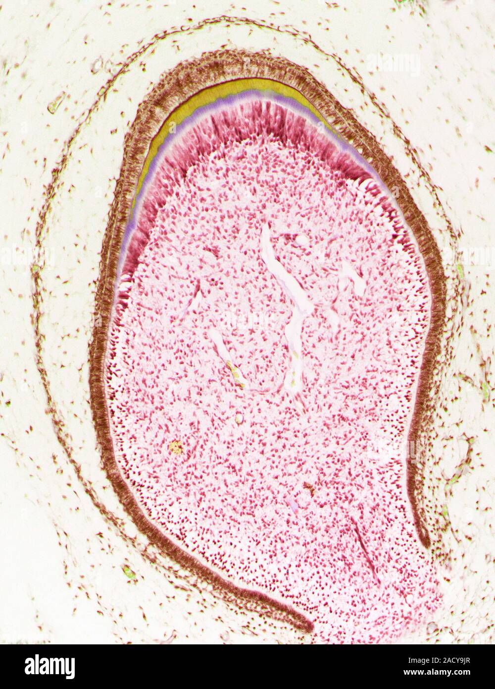 Foetal tooth. Coloured light micrograph (LM) of a section through of an ...