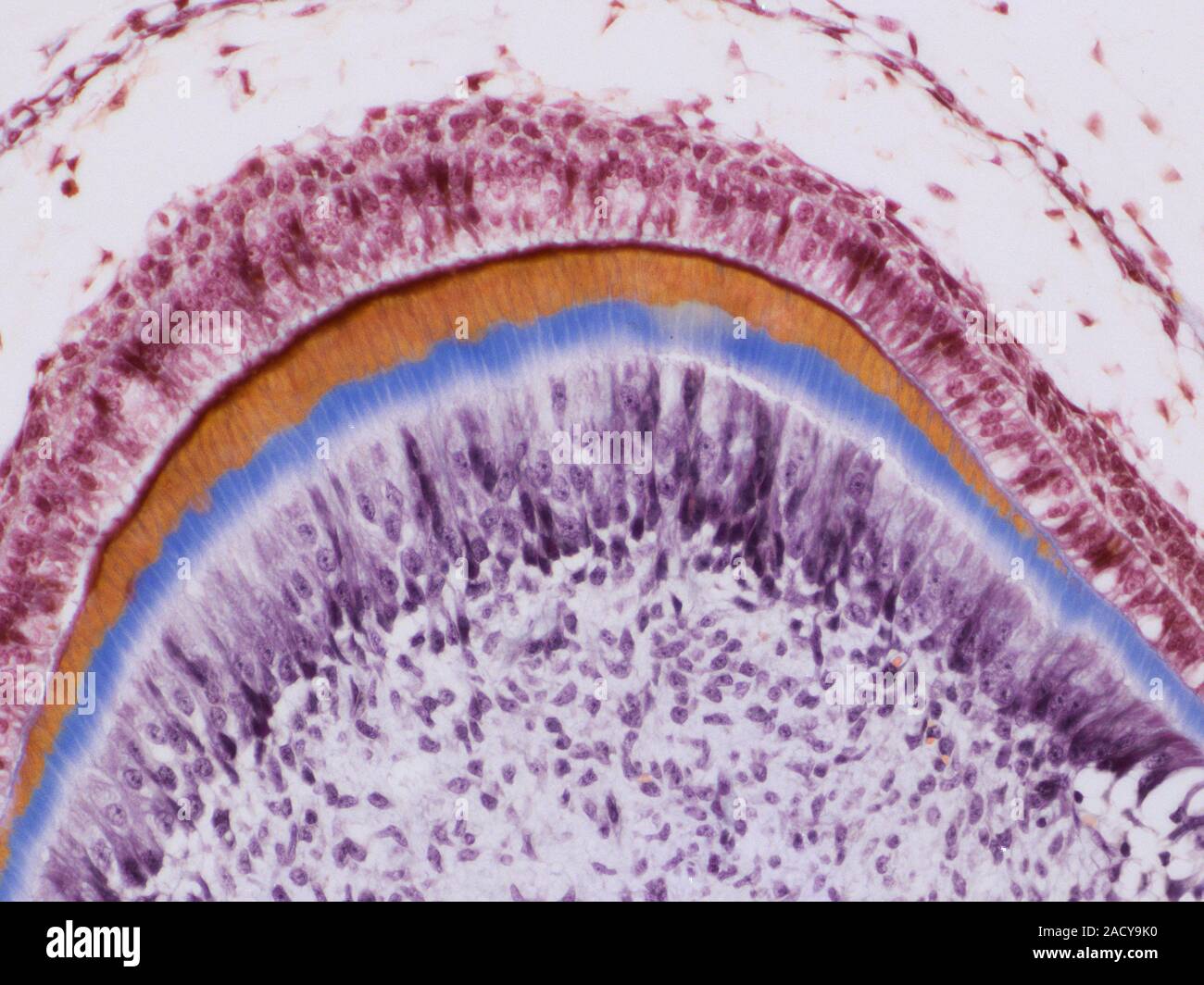 Foetal tooth. Coloured light micrograph (LM) of a section through the ...