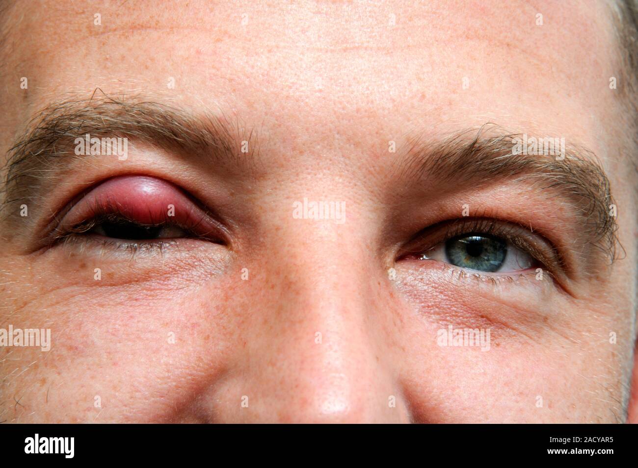 Not for use in Television Not for use in Television Stye. Close-up of a ...