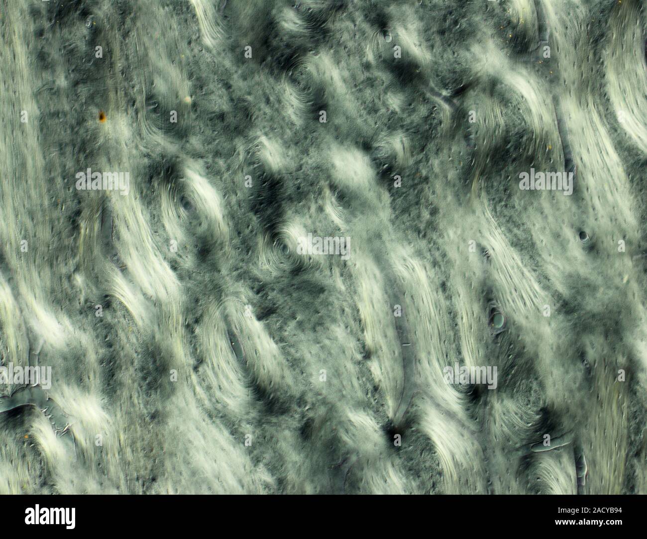 Bone tissue. Light micrograph of a section through adult compact bone ...