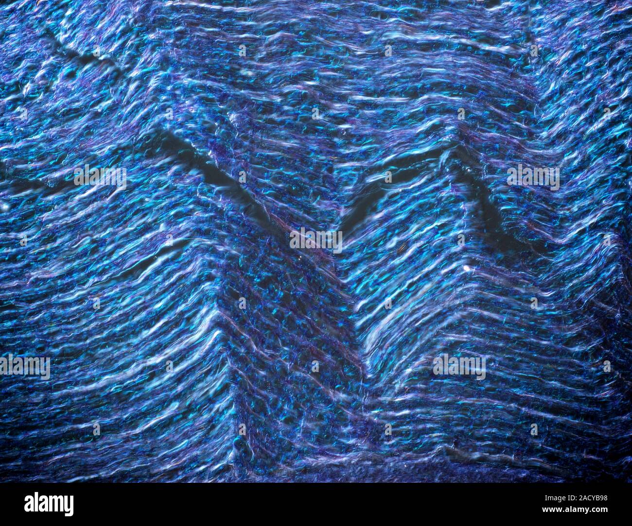 Normarski differential interference contrast (DIC) light micrograph of ...