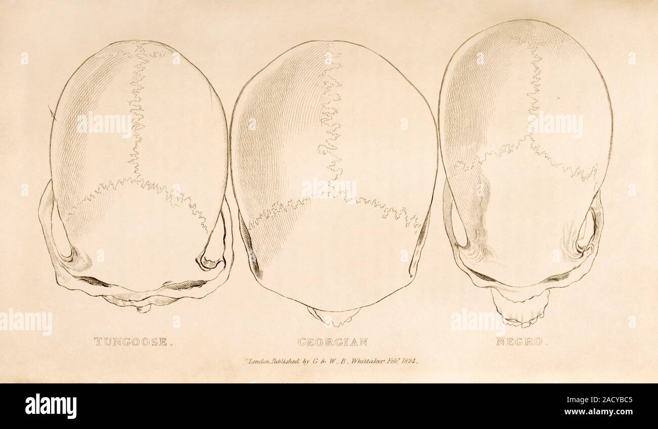 Human skulls. Artwork of Mongolian (left), Caucasian (centre) and ...