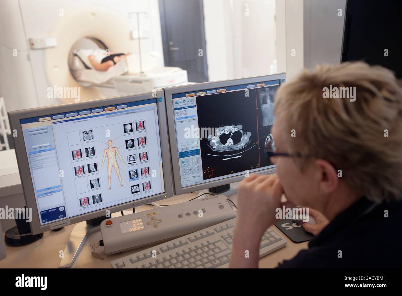 CT scanning. Radiologist examining CT (computed tomography) scans in a ...