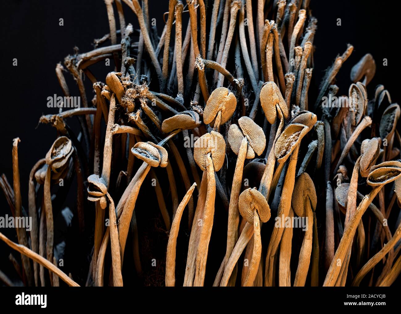 Raspberry stamens, coloured scanning electron micrograph (SEM). The ...