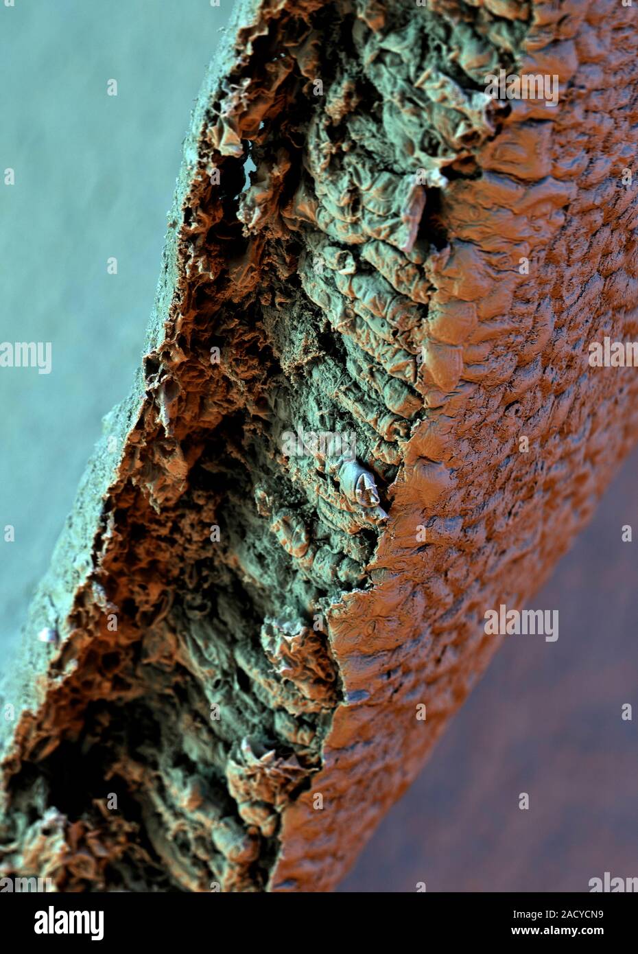 Broccoli. Coloured scanning electron micrograph (SEM) of plant tissue ...