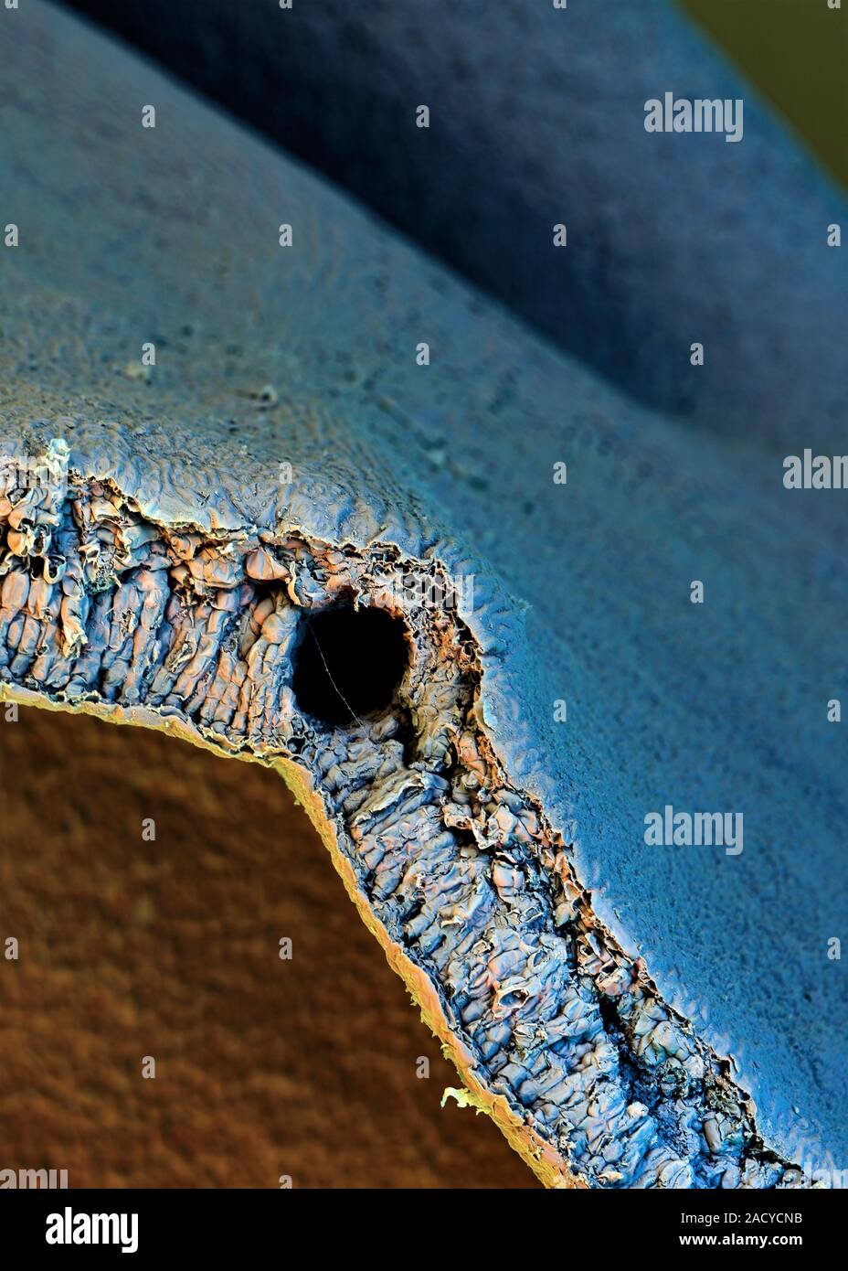 Broccoli. Coloured scanning electron micrograph (SEM) of plant tissue ...