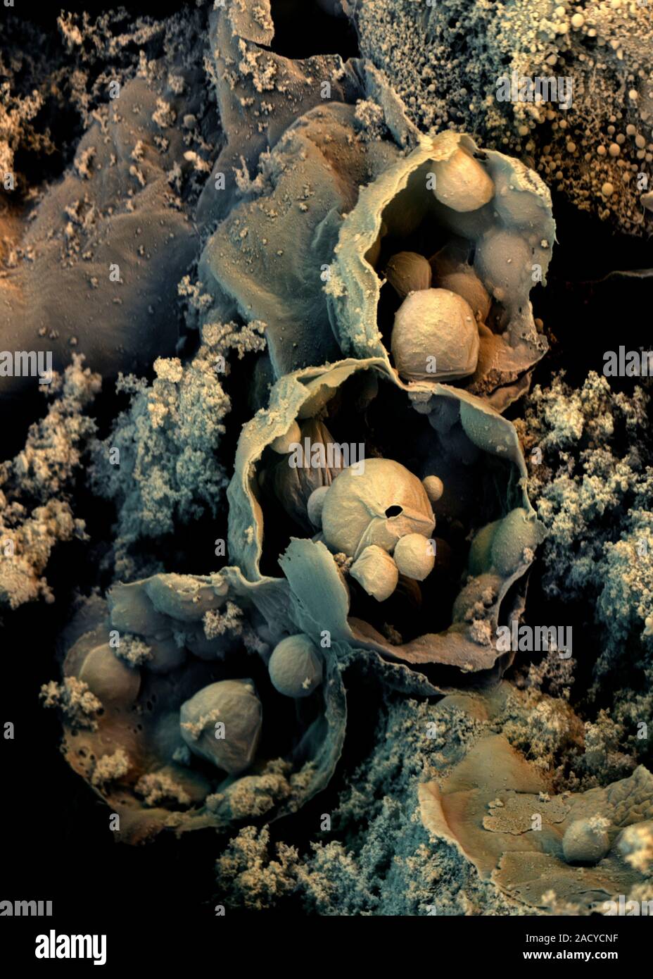 Broccoli. Coloured scanning electron micrograph (SEM) of plant tissue ...