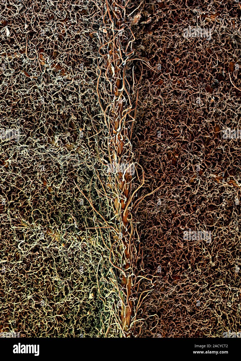 Raspberry (Rubus idaeus) leaf trichomes, coloured scanning electron ...