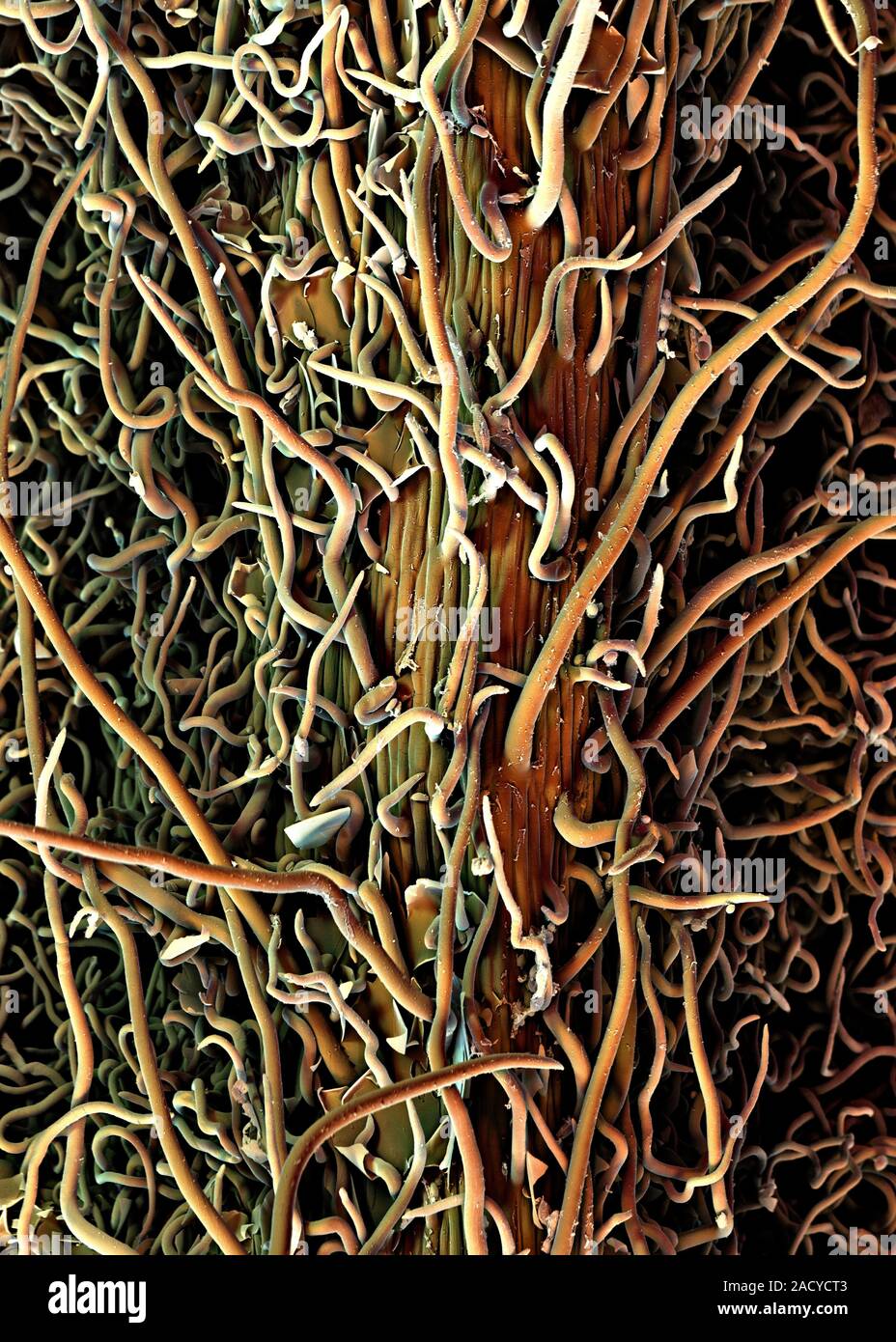 Raspberry (Rubus idaeus) leaf trichomes, coloured scanning electron ...