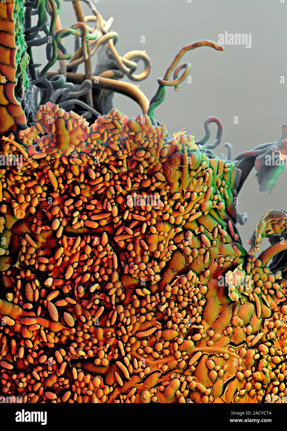 Raspberry (Rubus idaeus) leaf, coloured scanning electron micrograph ...