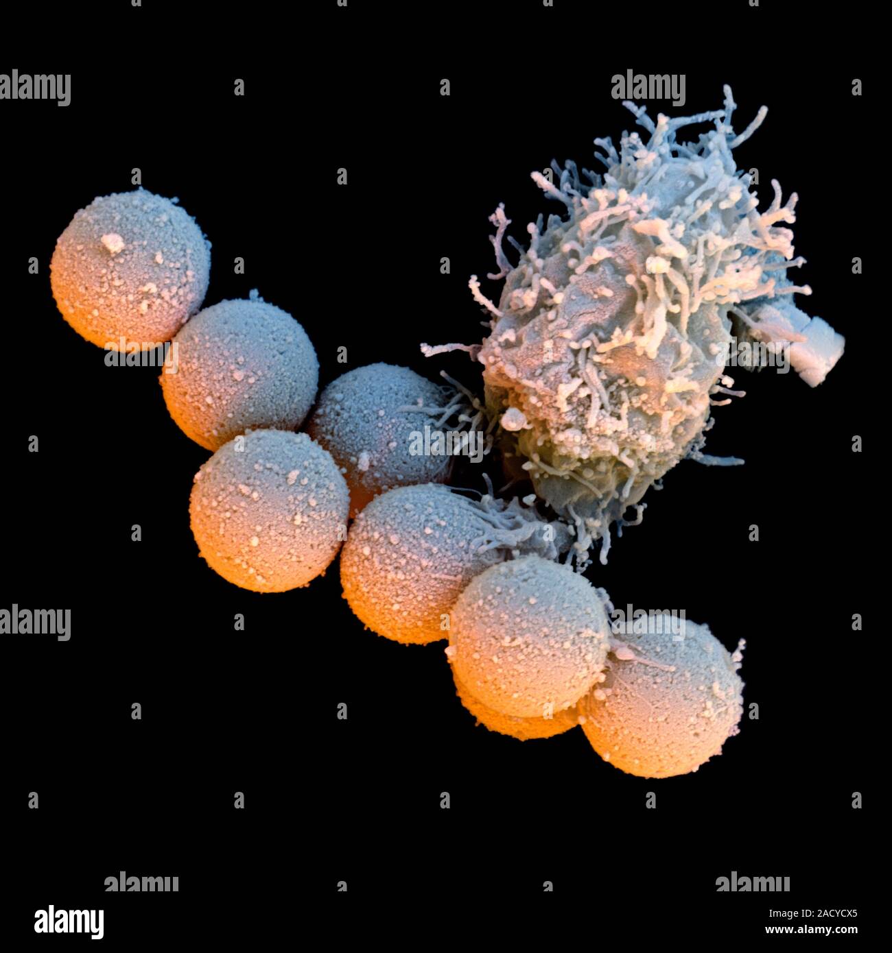 T-lymphocyte and iron particles, coloured scanning electron micrograph ...
