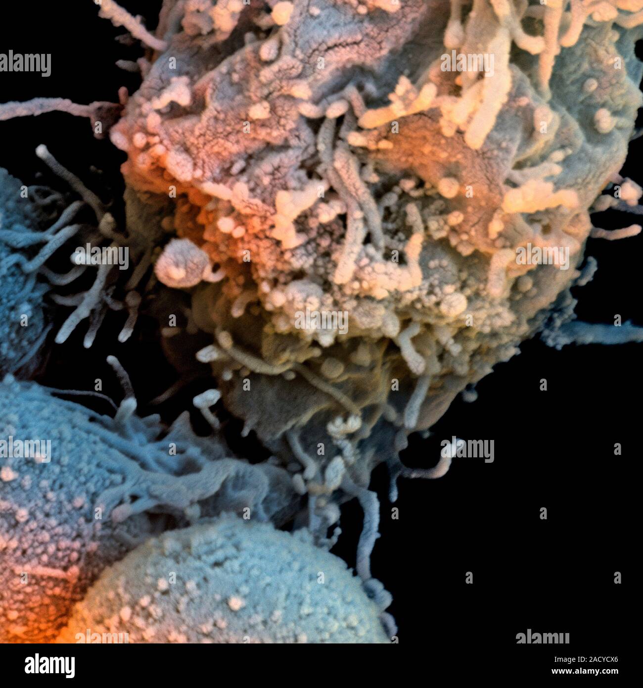 T-lymphocyte and iron particles, coloured scanning electron micrograph ...