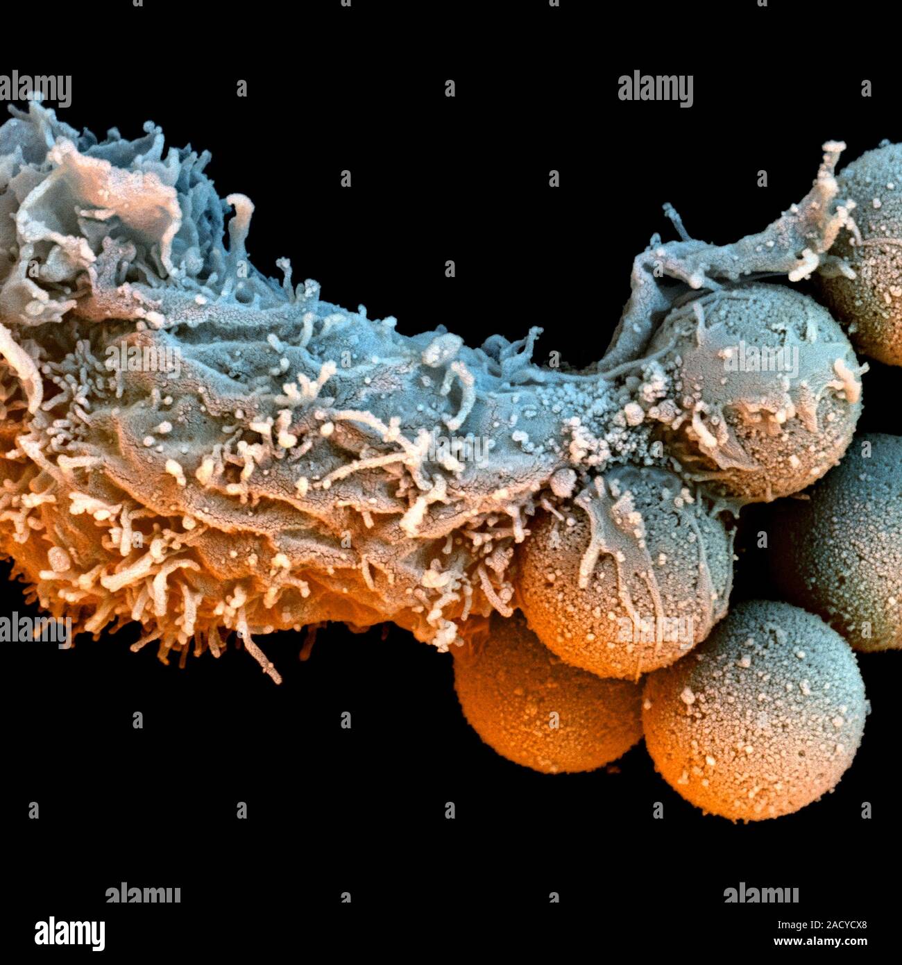 T-lymphocyte and iron particles, coloured scanning electron micrograph ...
