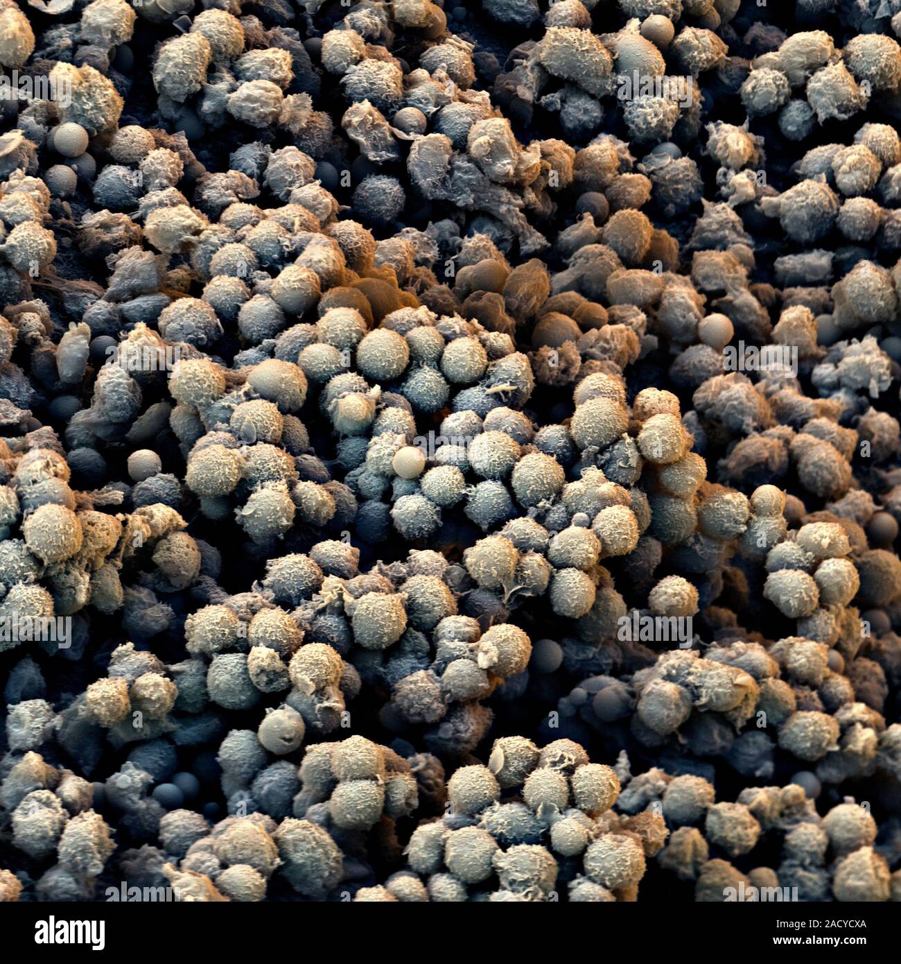 T-lymphocyte white blood cells, coloured scanning electron micrograph ...