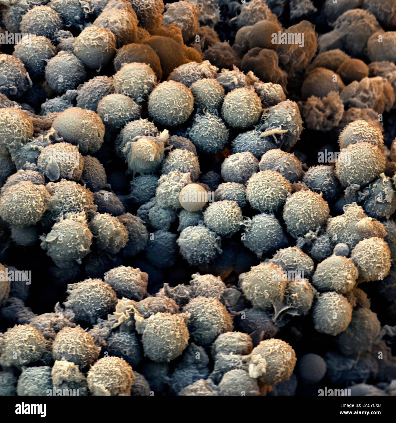 T-lymphocyte white blood cells, coloured scanning electron micrograph ...