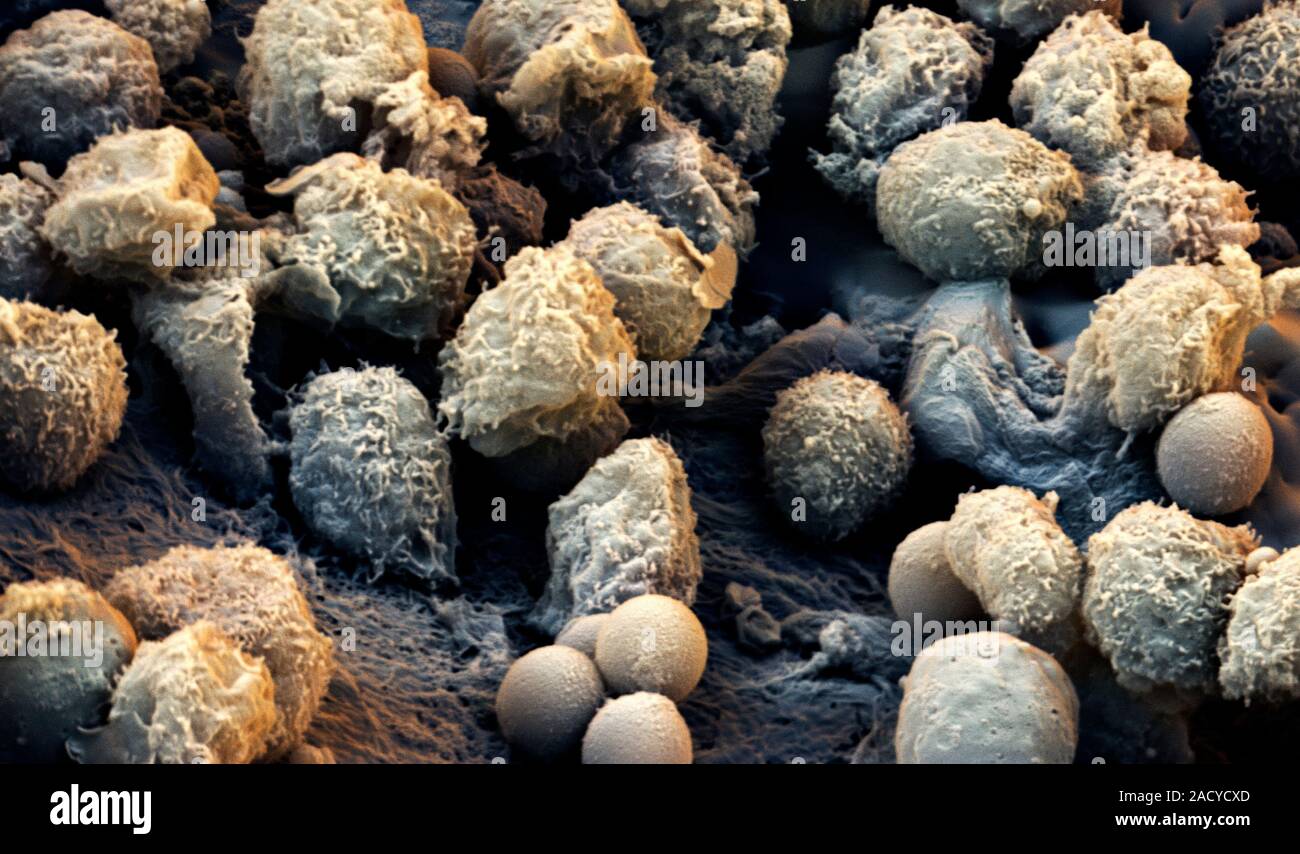 T-lymphocyte white blood cells, coloured scanning electron micrograph ...