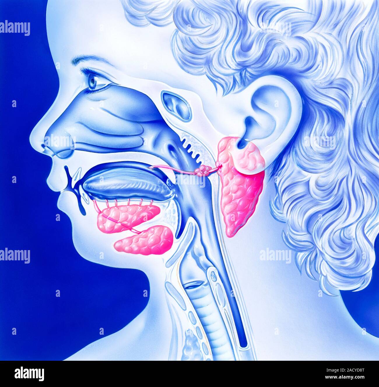 Mumps and salivary glands. Artwork of a side view of the face of a ...