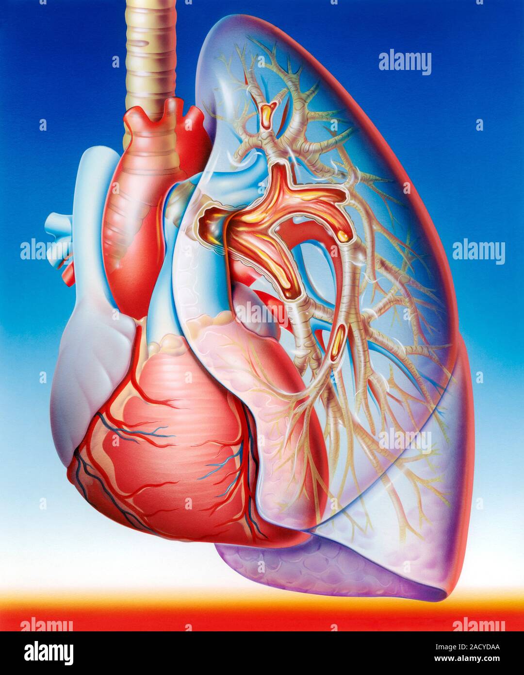Lower respiratory tract infection. Artwork of a lung and heart, showing ...