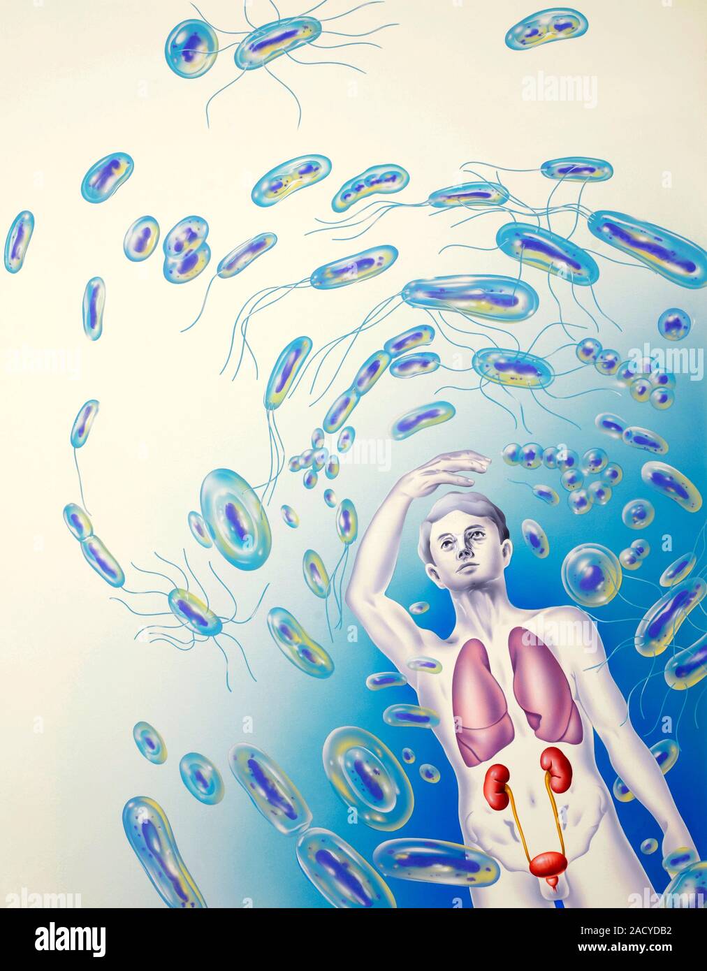 Bacterial infections. Artwork of bacteria surrounding a human figure ...