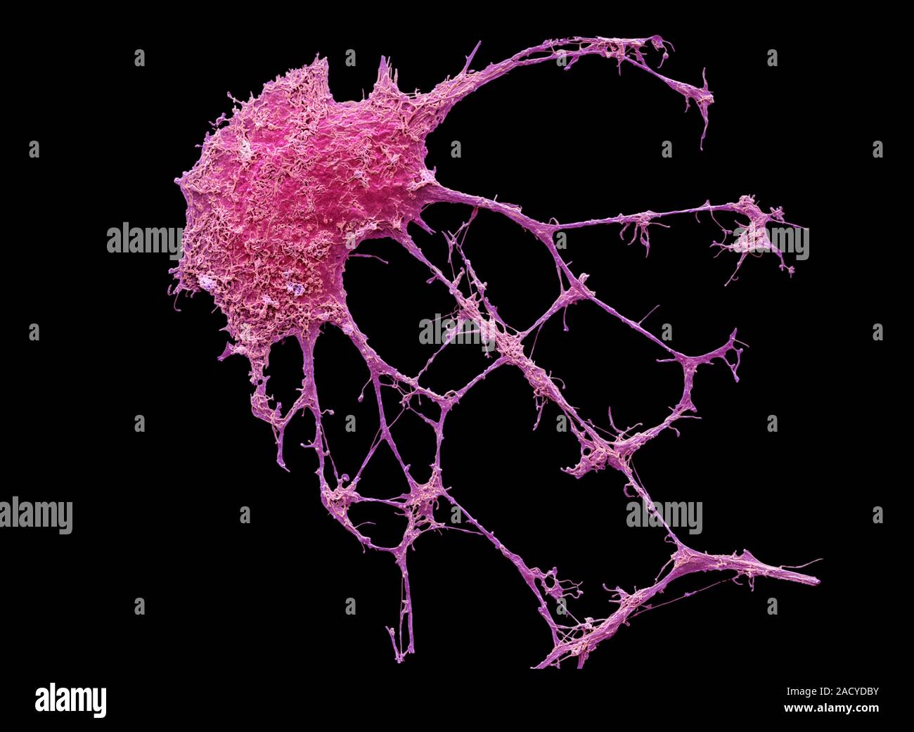 Neurone. Scanning electron micrograph (SEM) of a PC12 neurone in ...