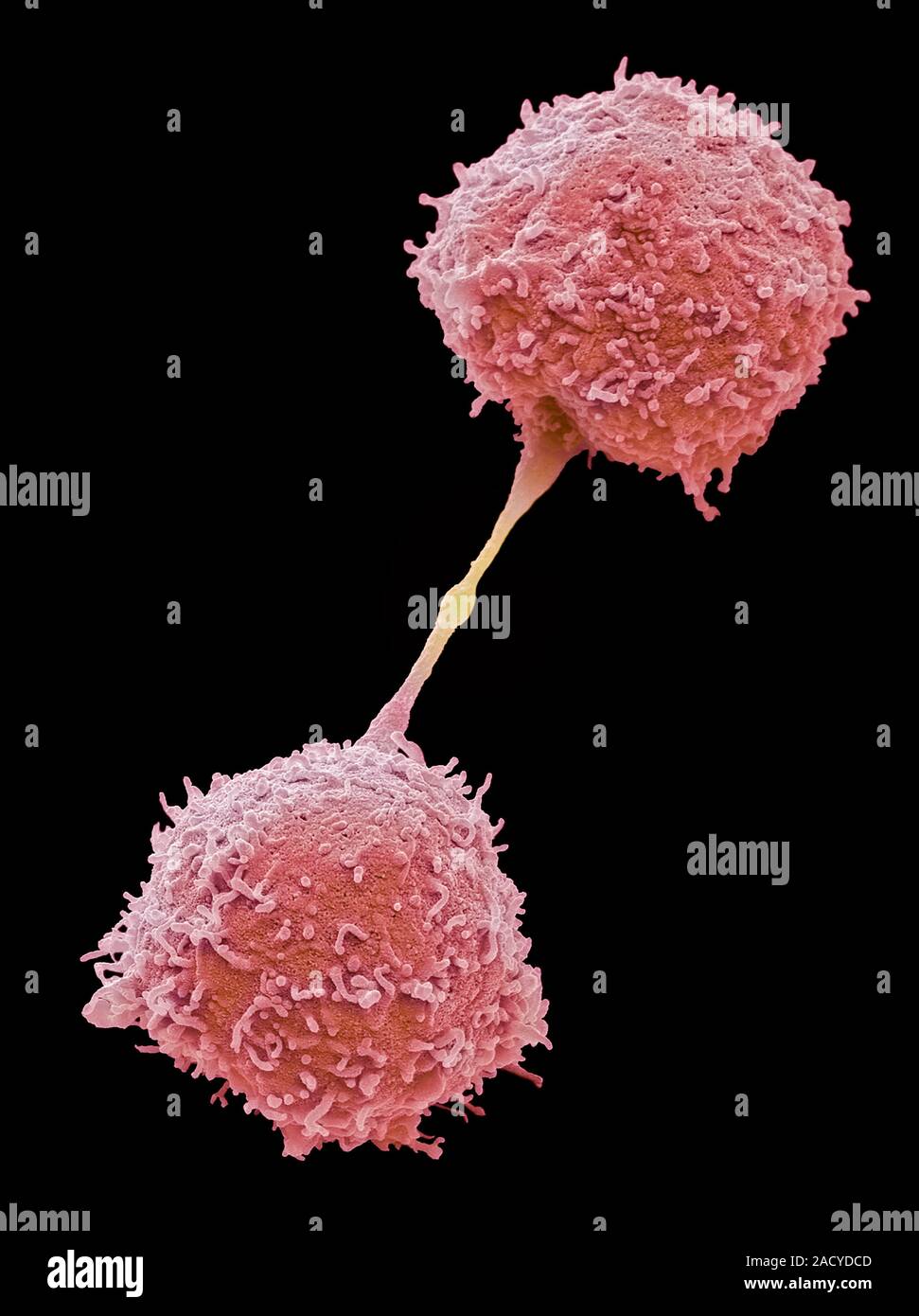 Coloured scanning electron micrograph (SEM) of dividing lymphocytes ...