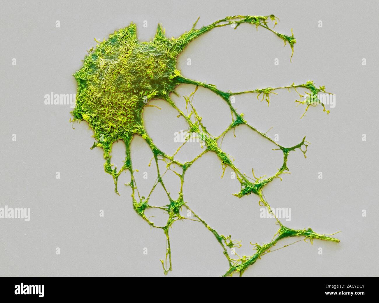 Neurone. Scanning electron micrograph (SEM) of a PC12 neurone in ...