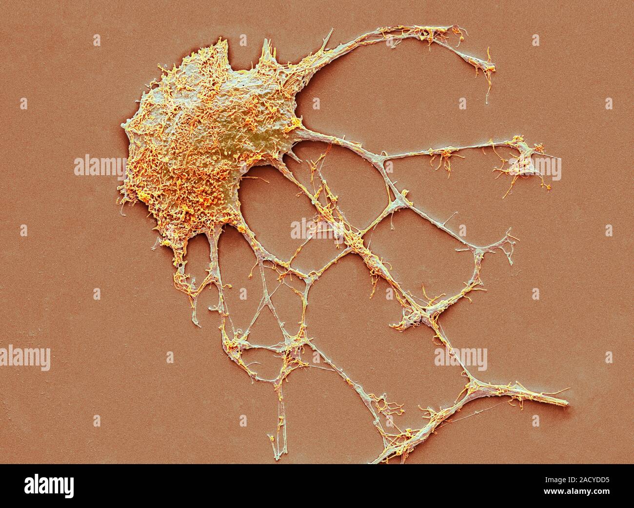 Neurone. Scanning electron micrograph (SEM) of a PC12 neurone in ...