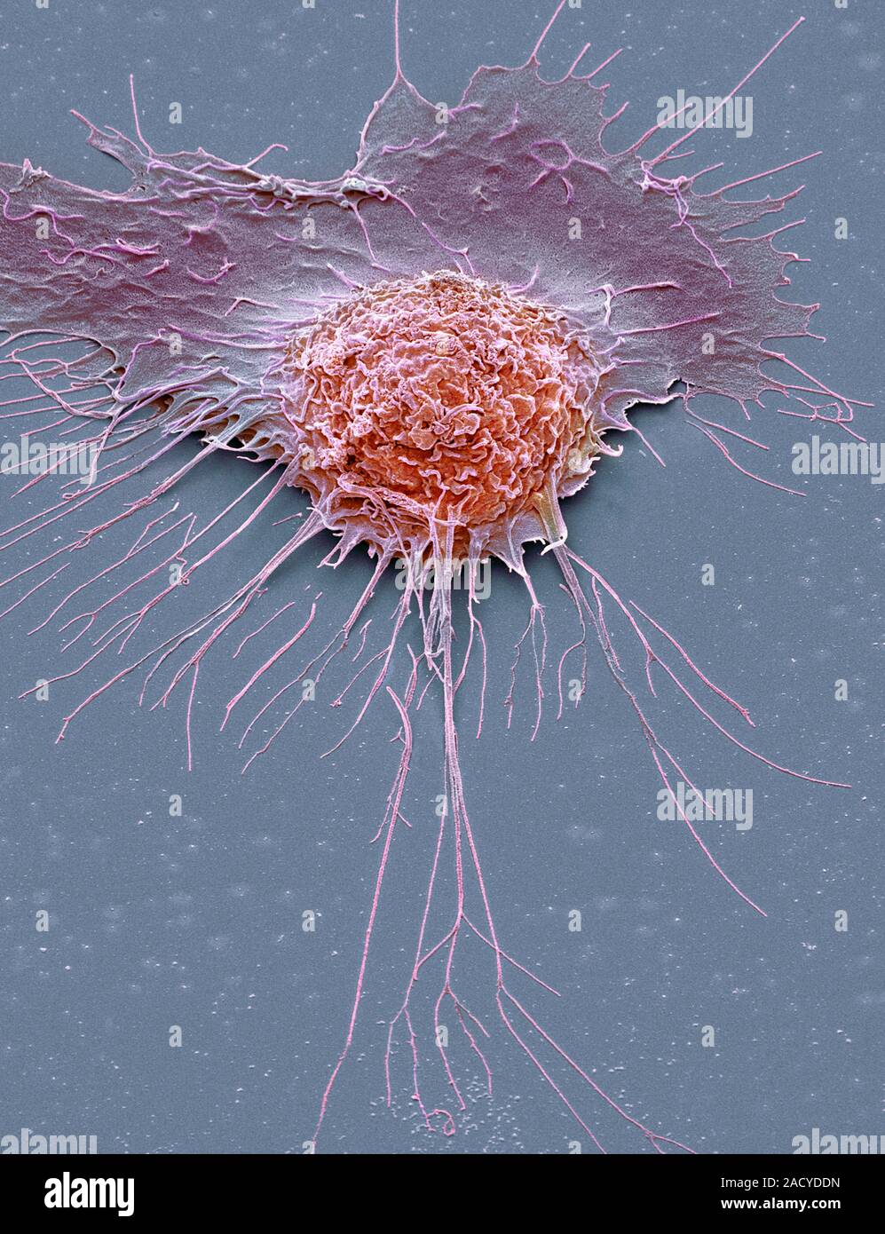 Bronchial epithelium. Coloured scanning electron micrograph (SEM) of a ...