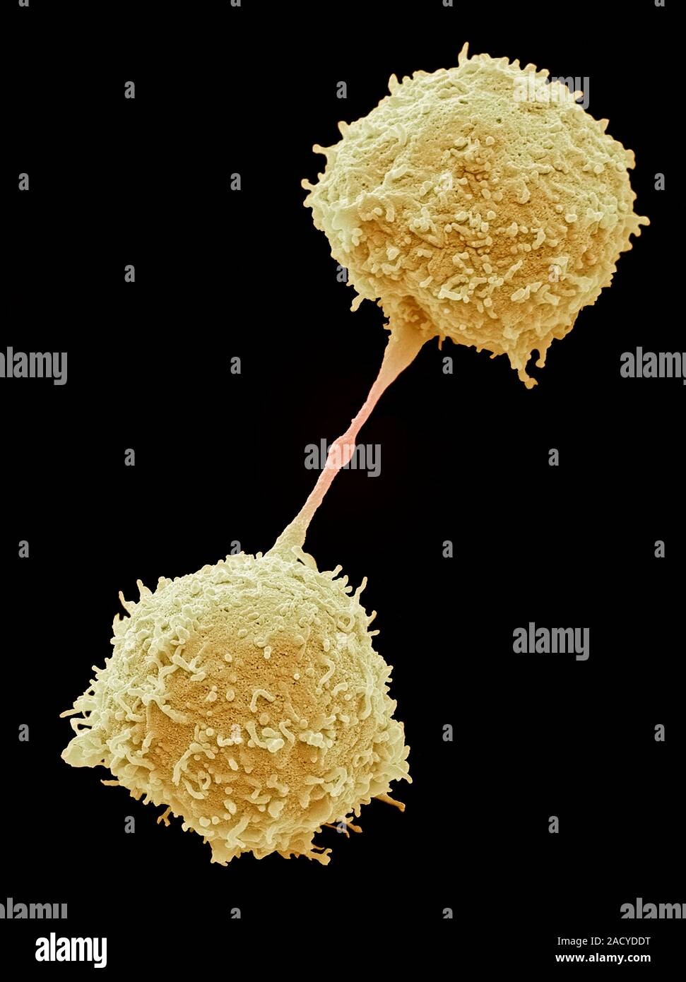 Coloured scanning electron micrograph (SEM) of dividing lymphocytes ...
