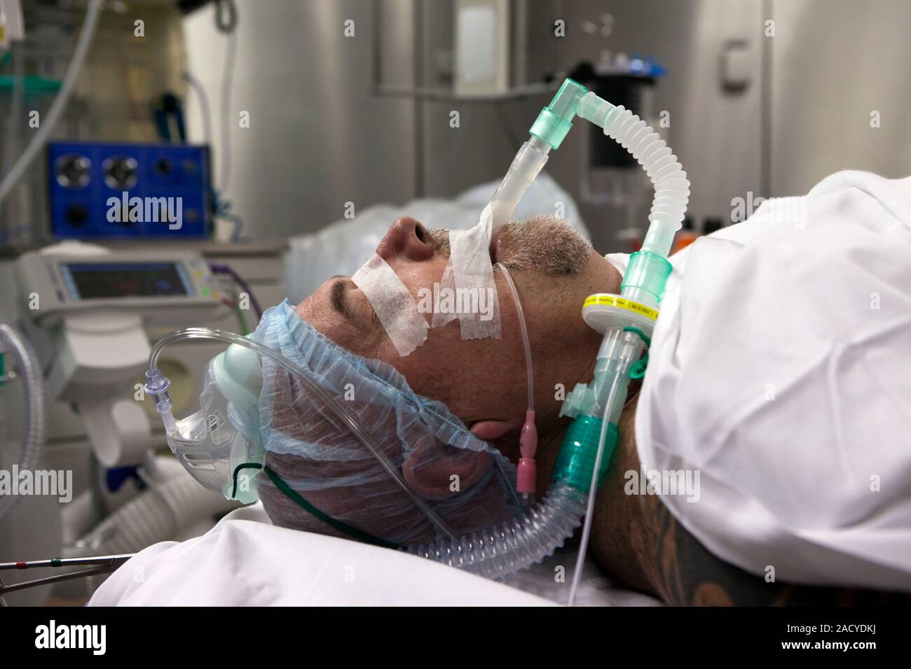 Intubated patient. The anaesthetised patient has been intubated prior ...
