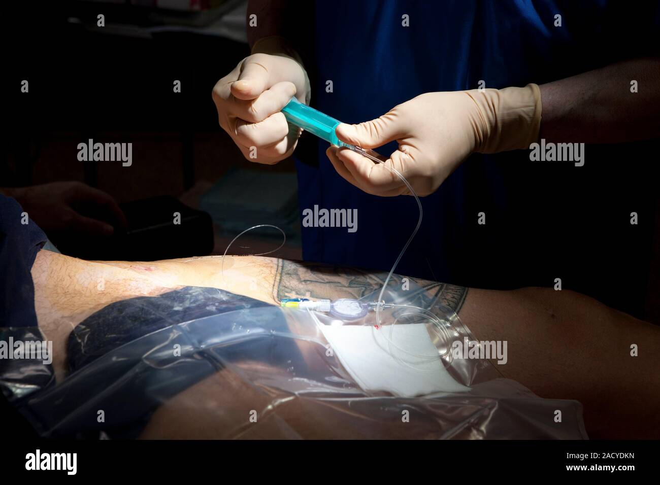 Femoral nerve block. Anaesthetist injecting anaesthetic into patient's ...