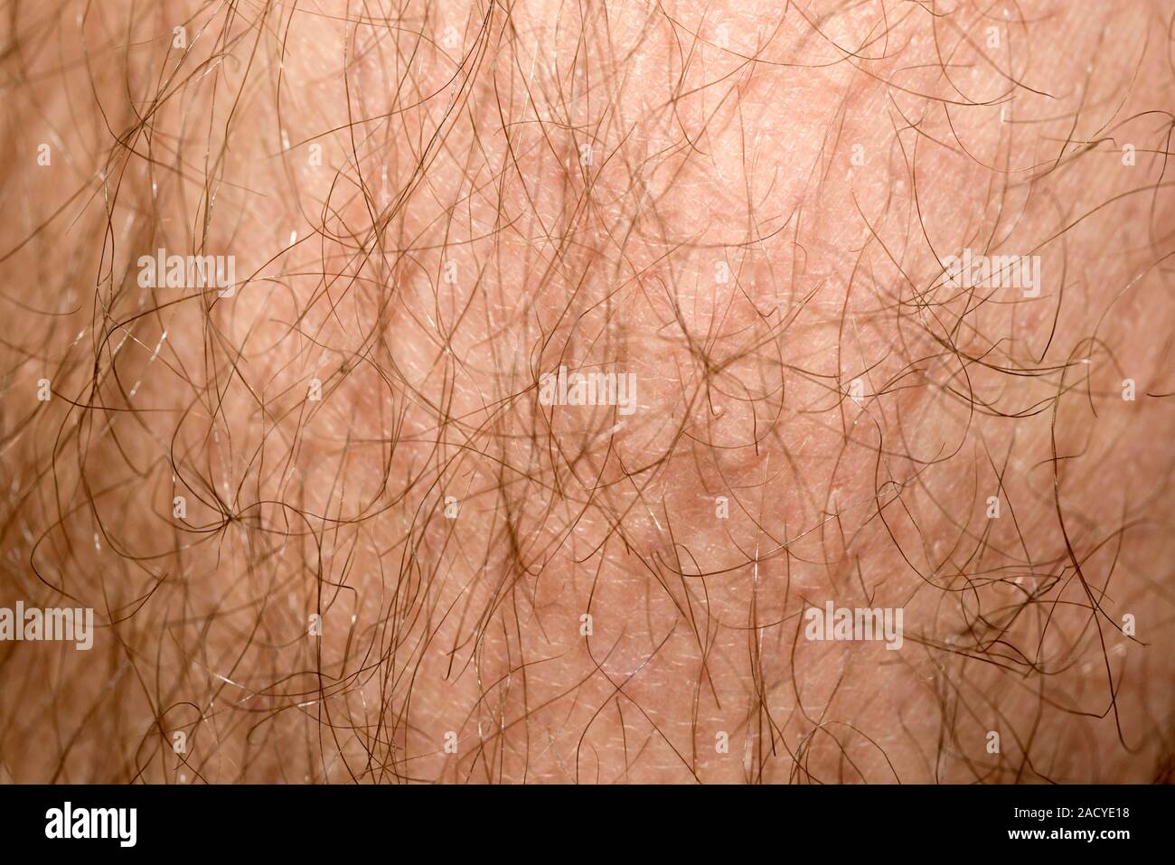 Male leg hair. Close-up view of hair on the skin of a man's leg Stock ...