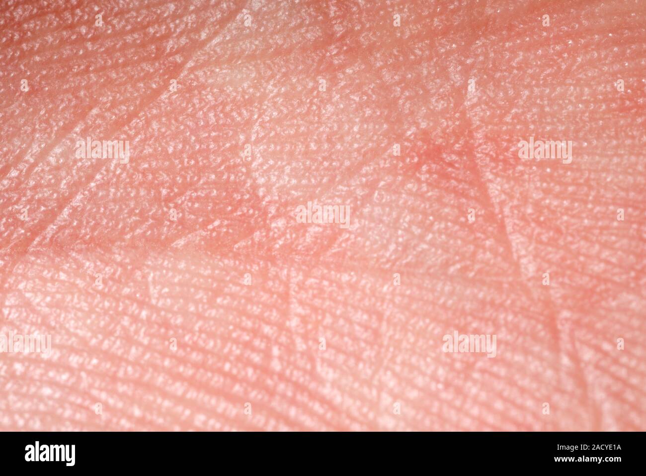 Ridges on palm of hand. Close-up of the lines and whorls of patterning ...