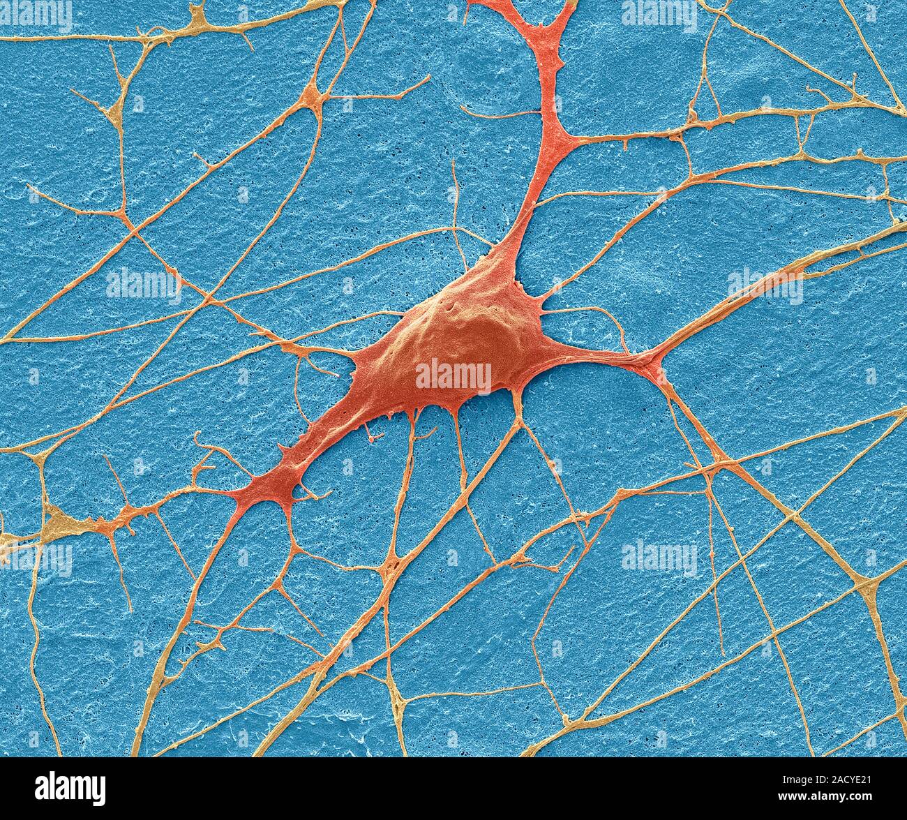 Stem cell-derived motor neuron. Coloured scanning electron micrograph ...