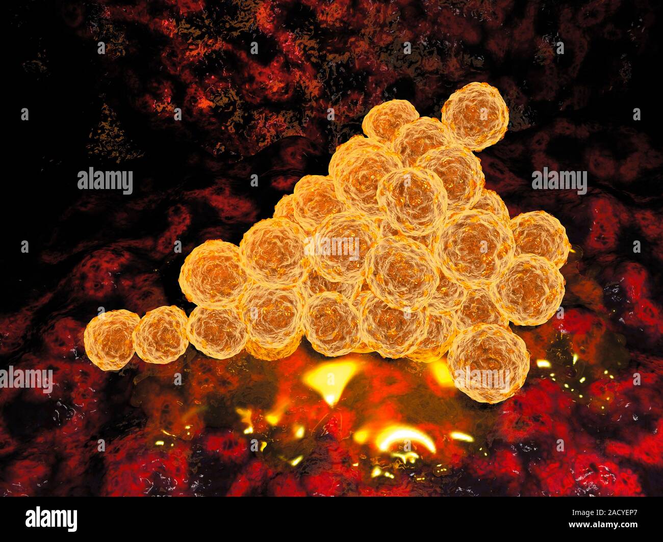 Methicillin-resistant Staphylococcus aureus bacteria (MRSA), computer ...