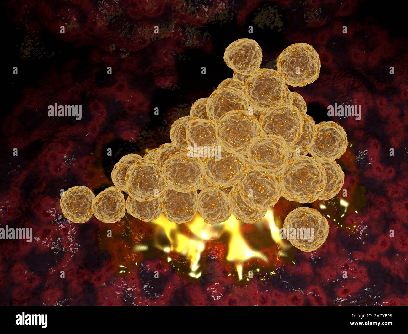 Methicillin-resistant Staphylococcus aureus bacteria (MRSA), computer ...