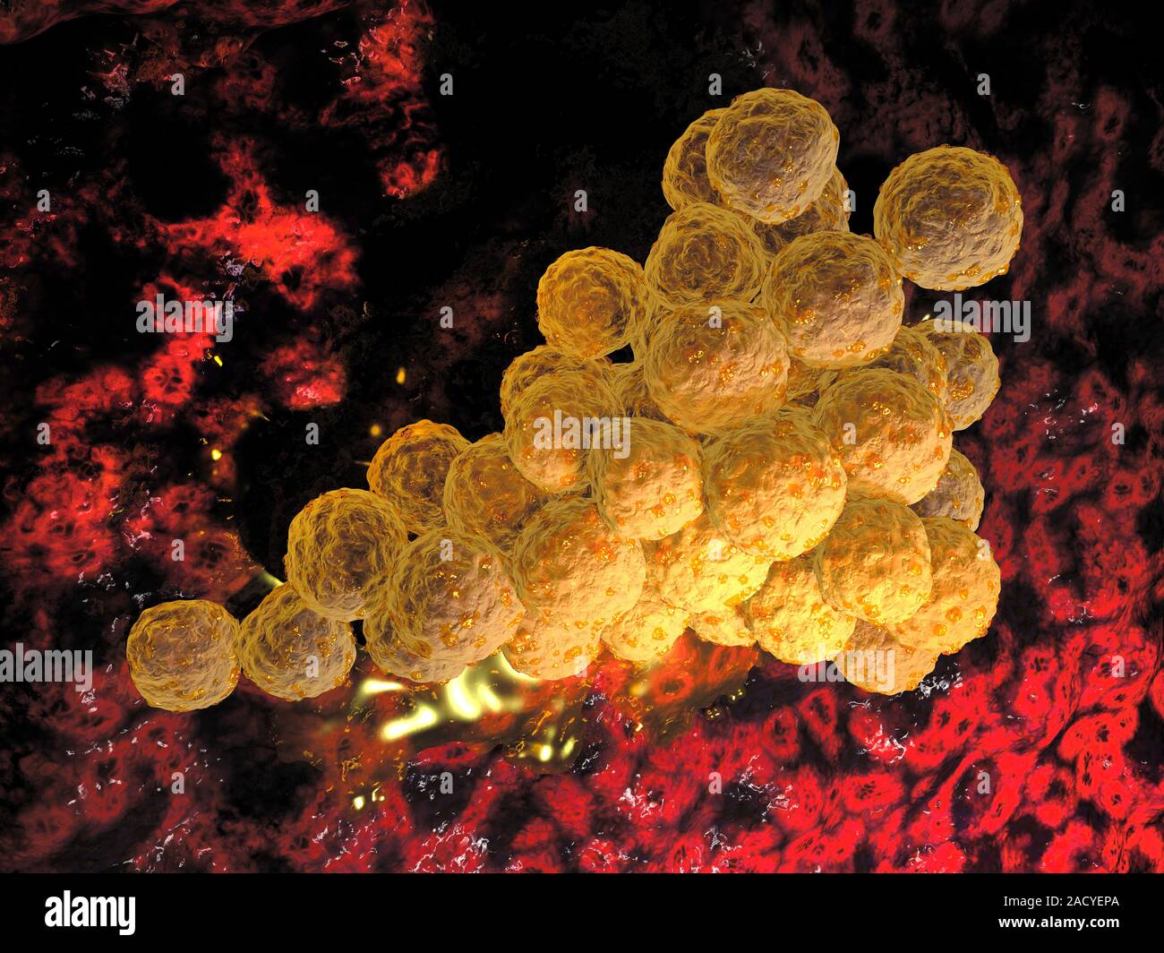 Methicillin-resistant Staphylococcus aureus bacteria (MRSA), computer artwork Stock Photo - Alamy