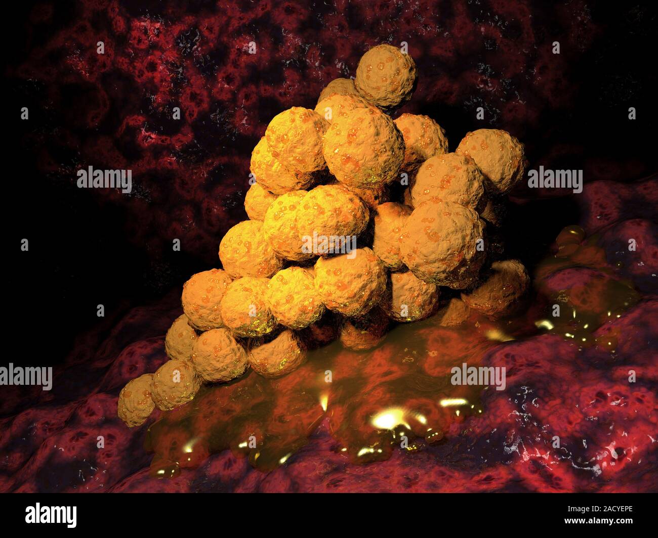 Methicillin-resistant Staphylococcus aureus bacteria (MRSA), computer artwork Stock Photo - Alamy