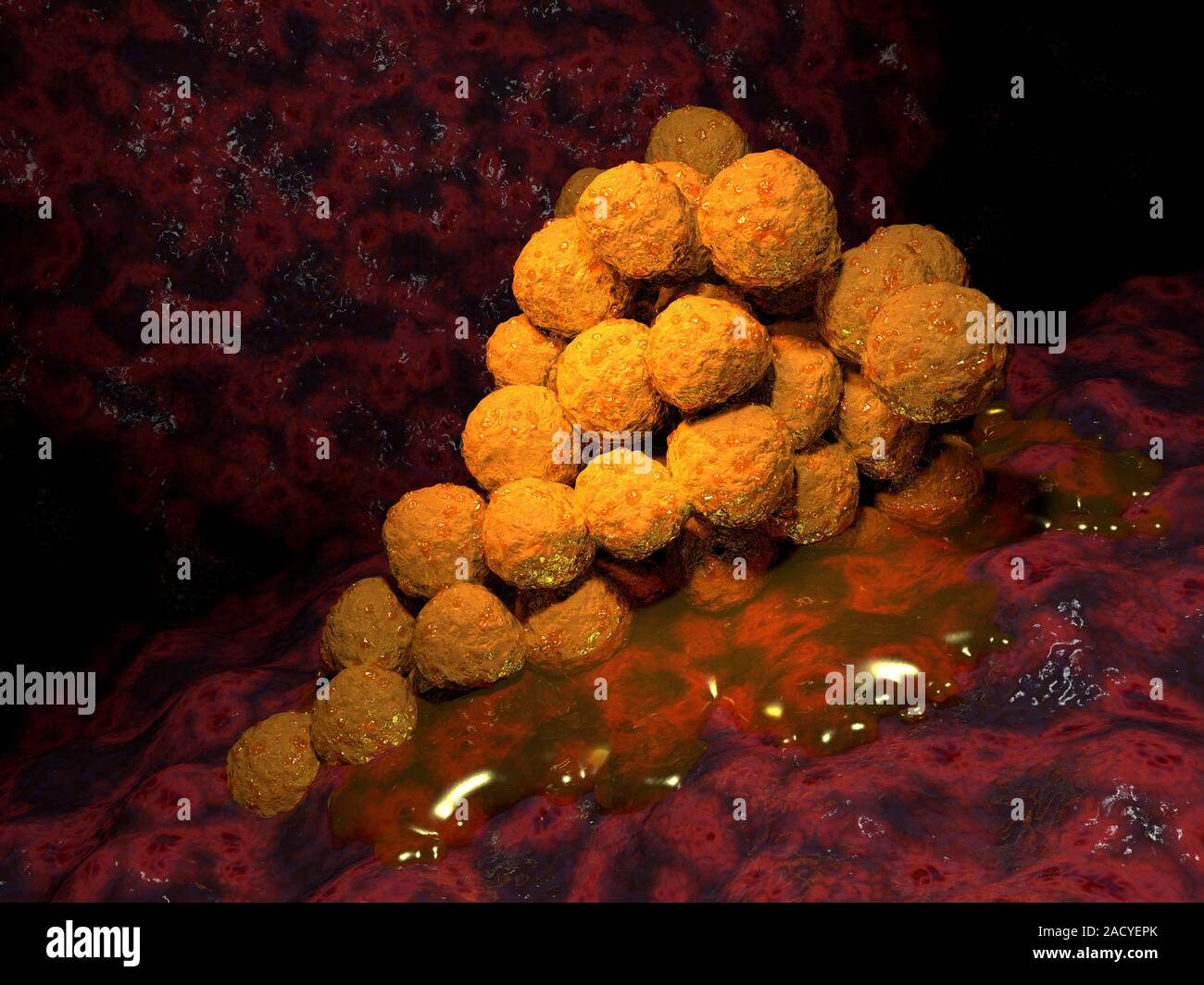 Methicillin-resistant Staphylococcus aureus bacteria (MRSA), computer artwork Stock Photo - Alamy