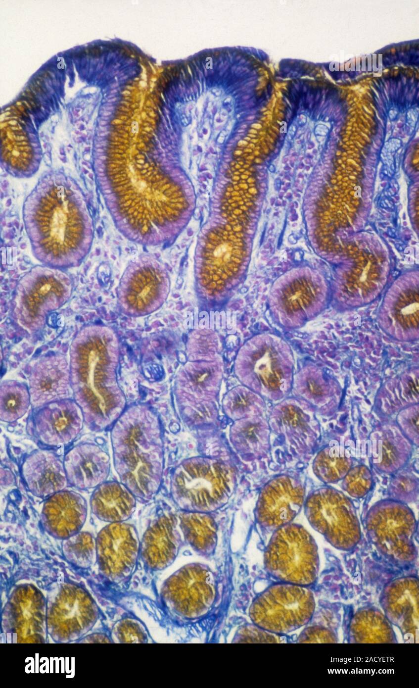 Stomach lining. Light micrograph of a section through the healthy ...