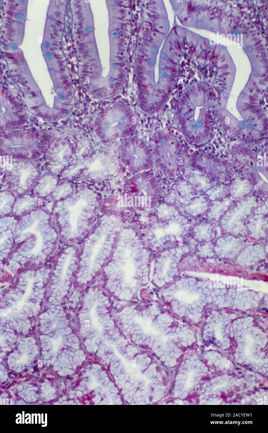 Small intestine lining. Light micrograph of a section through the ...
