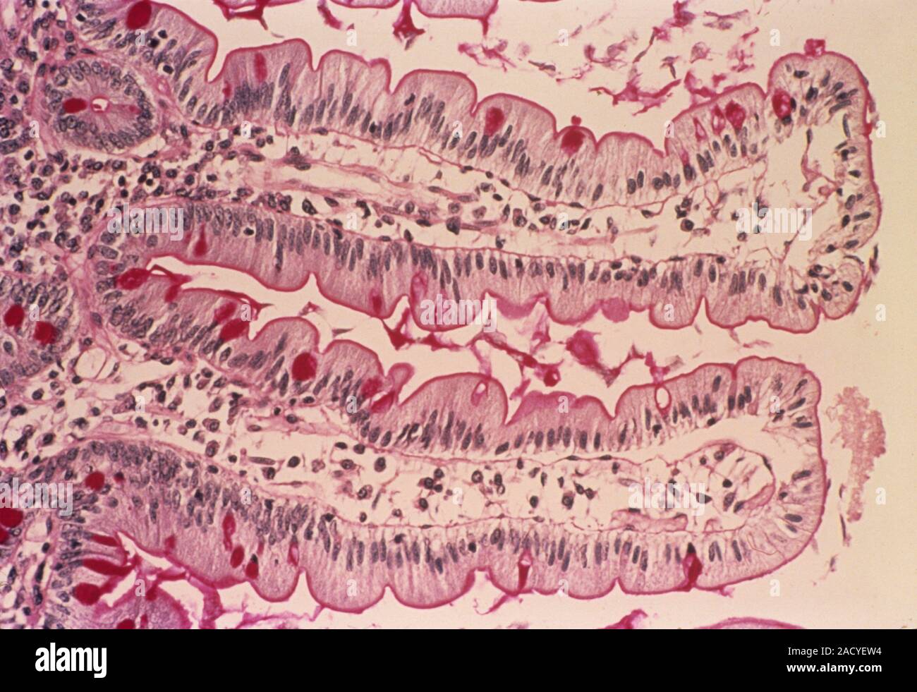 Small intestine lining. Light micrograph of a section through the ...